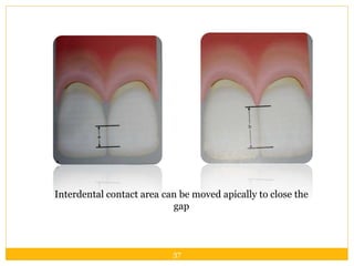 smile design | PPTX