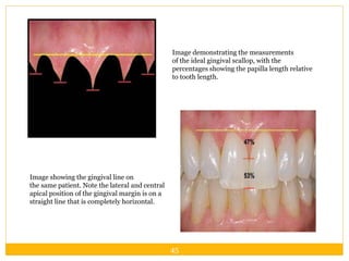 smile design | PPTX