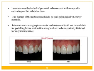 smile design | PPTX | Oral care | Personal Care
