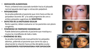 SEMANA 1. PTOSIS PARPEBRAL1.pdf
