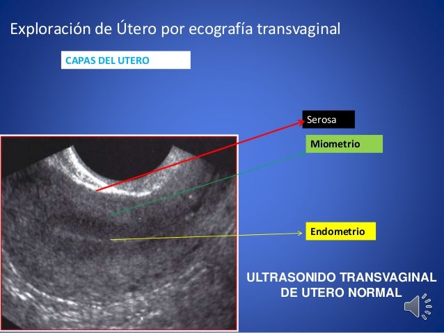 Semana 11.clase 2 anatomia por imagenes utero ,anexos ecografia 1er t…