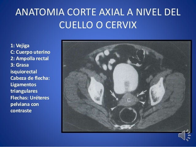 Semana 11.clase 2 anatomia por imagenes utero ,anexos ecografia 1er t…