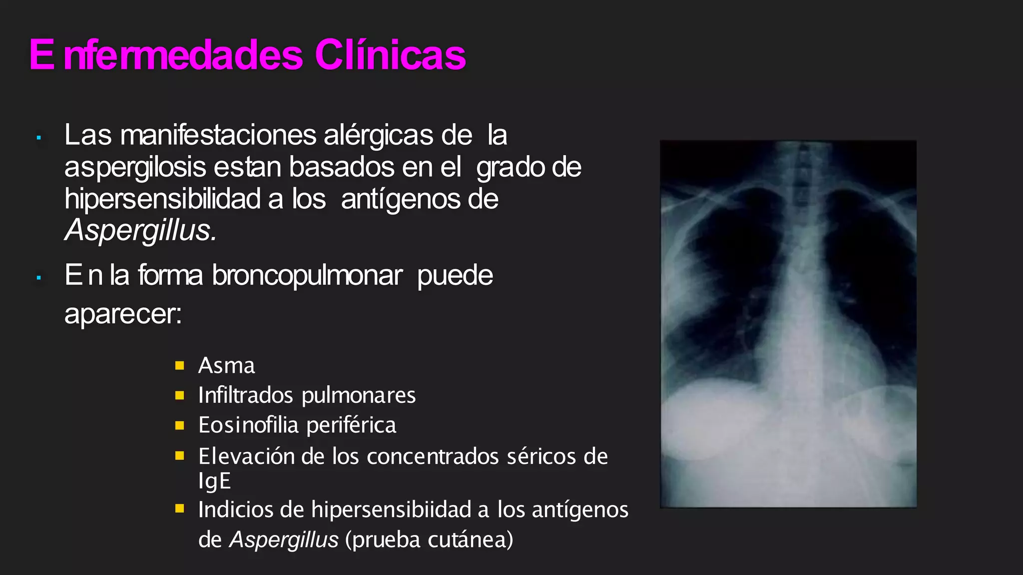 SEMANA 14- ASPERGILOSIS, MUCOR, ZYGOMICOSIS.pptx