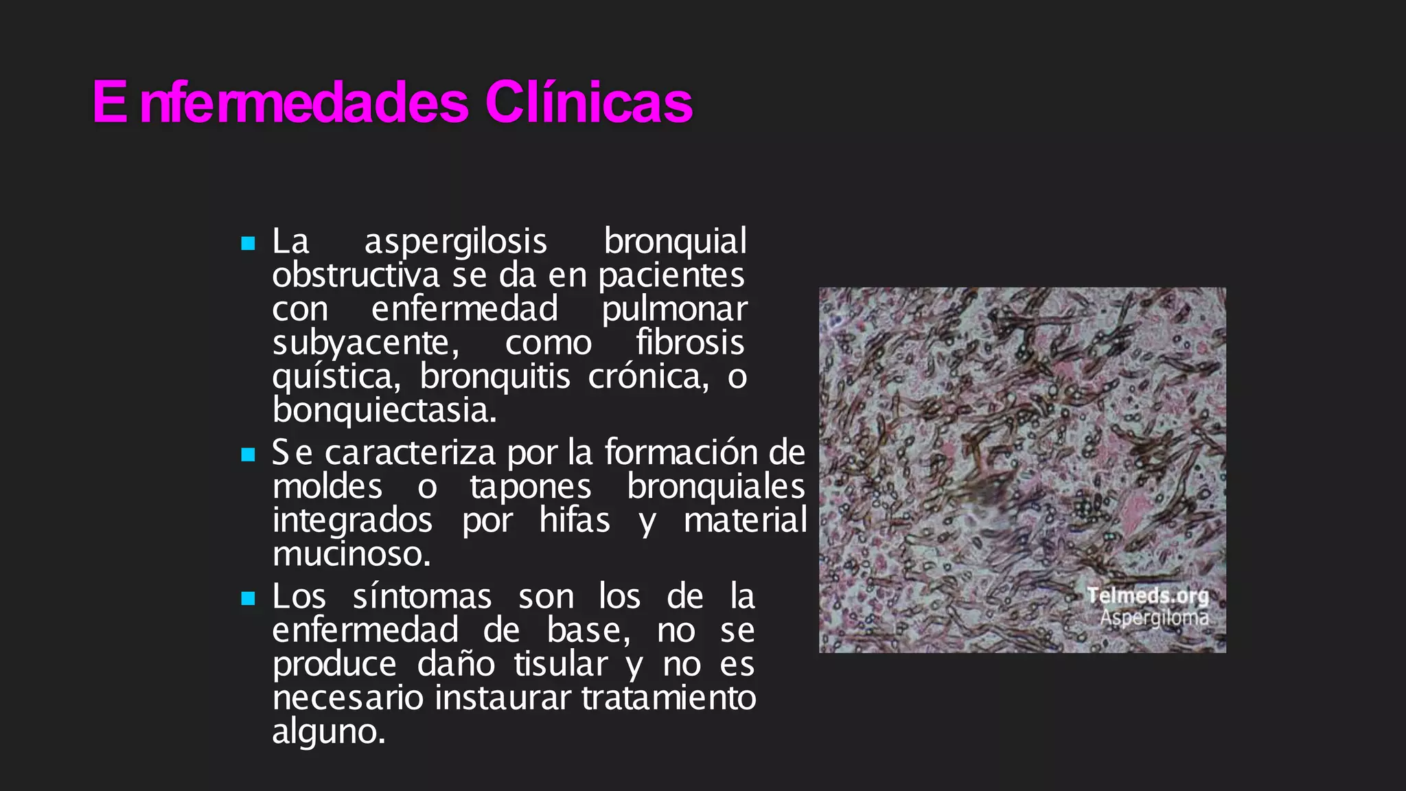 SEMANA 14- ASPERGILOSIS, MUCOR, ZYGOMICOSIS.pptx
