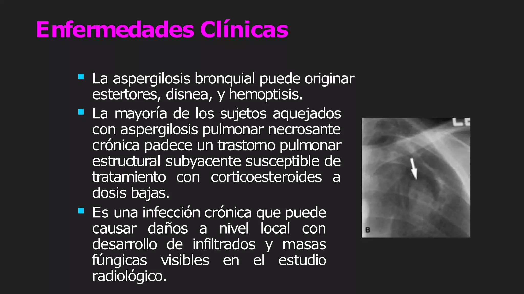 SEMANA 14- ASPERGILOSIS, MUCOR, ZYGOMICOSIS.pptx