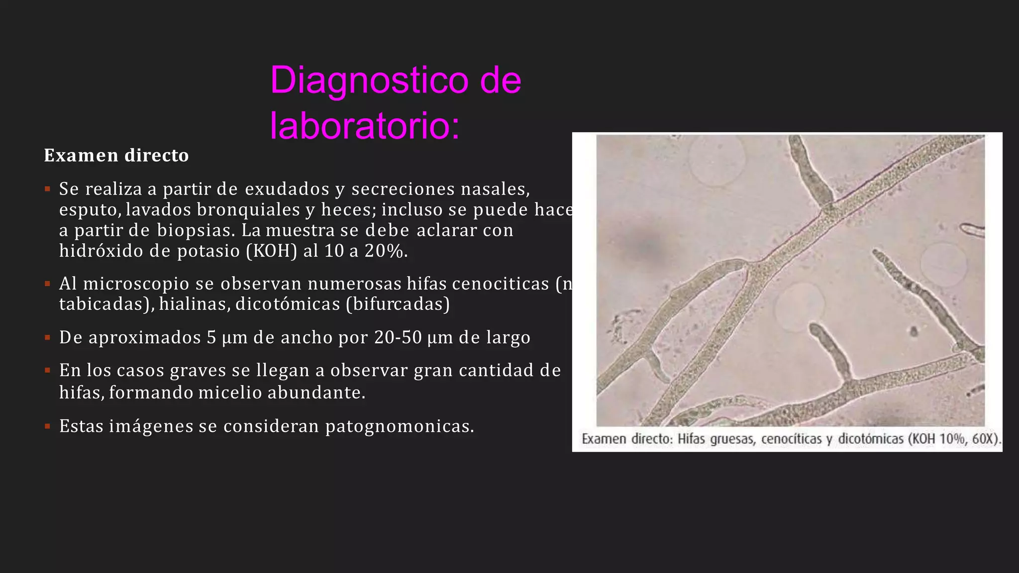 SEMANA 14- ASPERGILOSIS, MUCOR, ZYGOMICOSIS.pptx