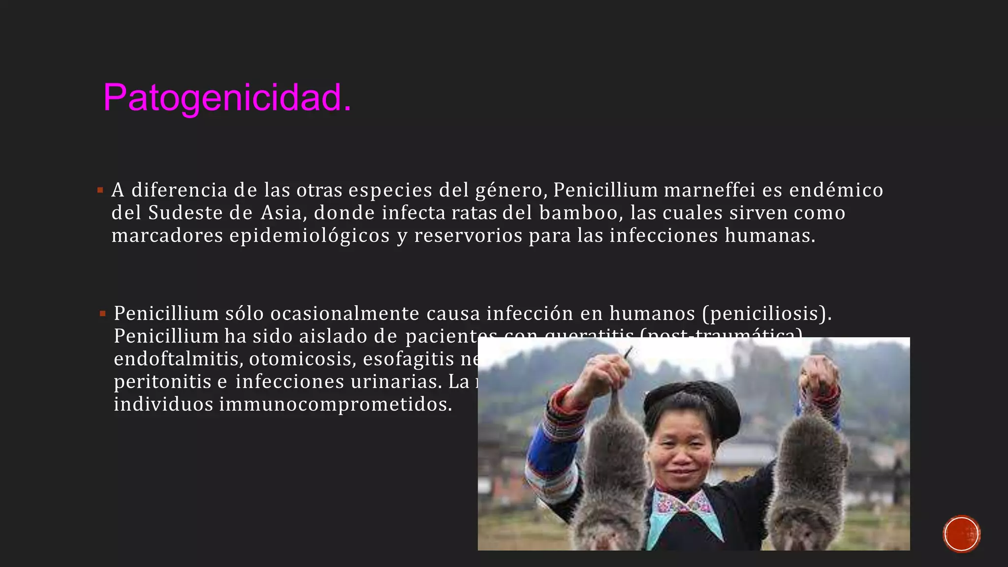 SEMANA 14- ASPERGILOSIS, MUCOR, ZYGOMICOSIS.pptx