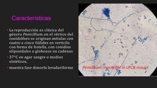 SEMANA 14- ASPERGILOSIS, MUCOR, ZYGOMICOSIS.pptx