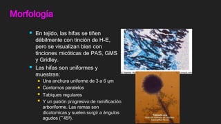SEMANA 14- ASPERGILOSIS, MUCOR, ZYGOMICOSIS.pptx
