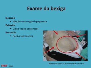 Aula Exame físico genitália masculina.pptx