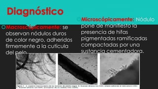 SEMANA 6 - TIÑA NEGRA - PIEDRAS.pdf