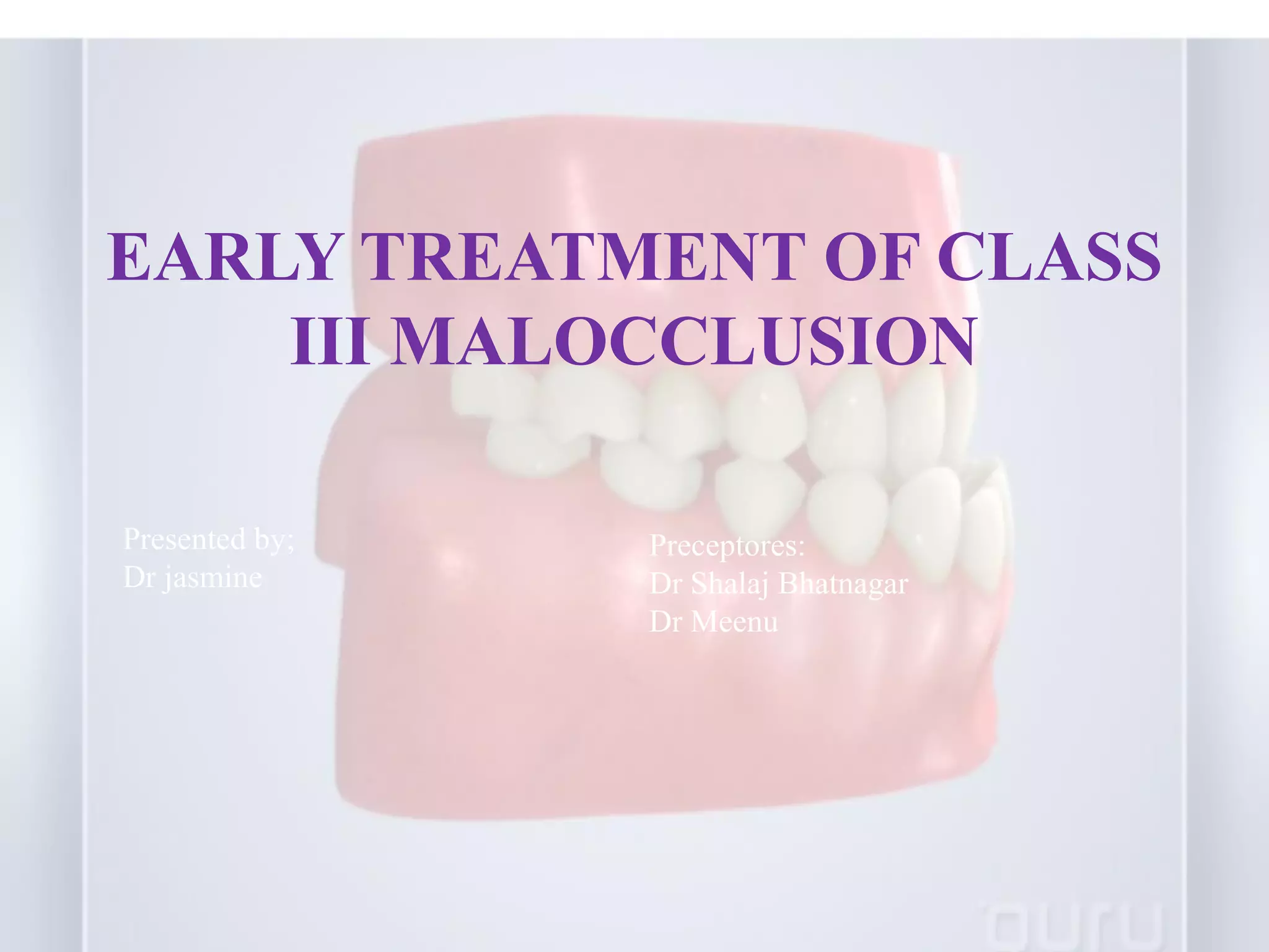 early treatment of class III malocclusion | PPT