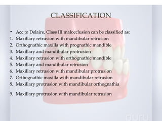 early treatment of class III malocclusion | PPT