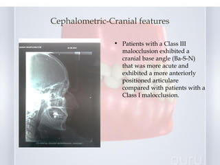 early treatment of class III malocclusion | PPT