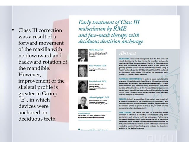 early treatment of class III malocclusion | PPT