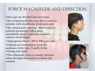 early treatment of class III malocclusion | PPT