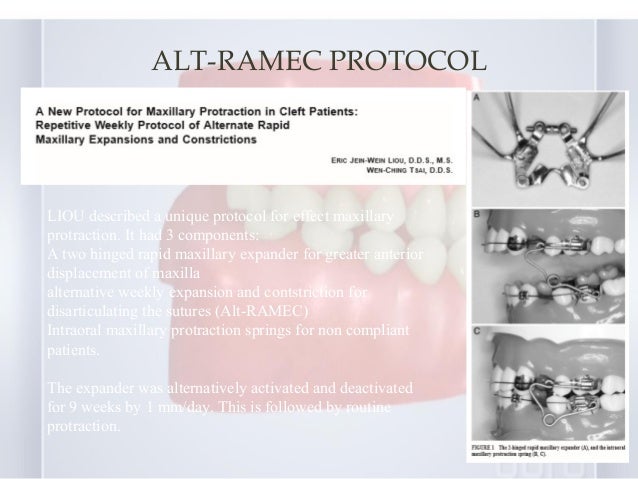 early treatment of class III malocclusion
