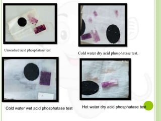 Semen analysis | PPTX