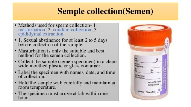 Semen analysis