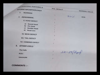 Semen Analysis Report