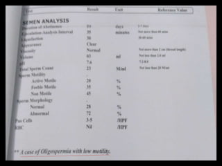 Semen Analysis Report The Semen Analysis “Sperm Test”