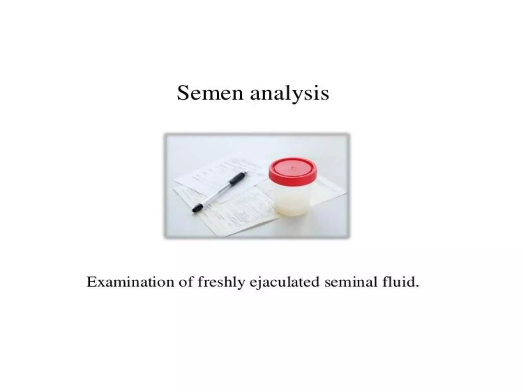 Semen analysis | PPT
