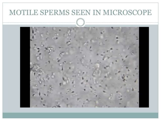 Semen analysis | PDF