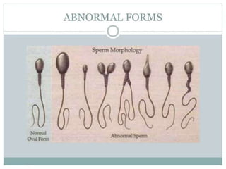 Semen analysis | PDF