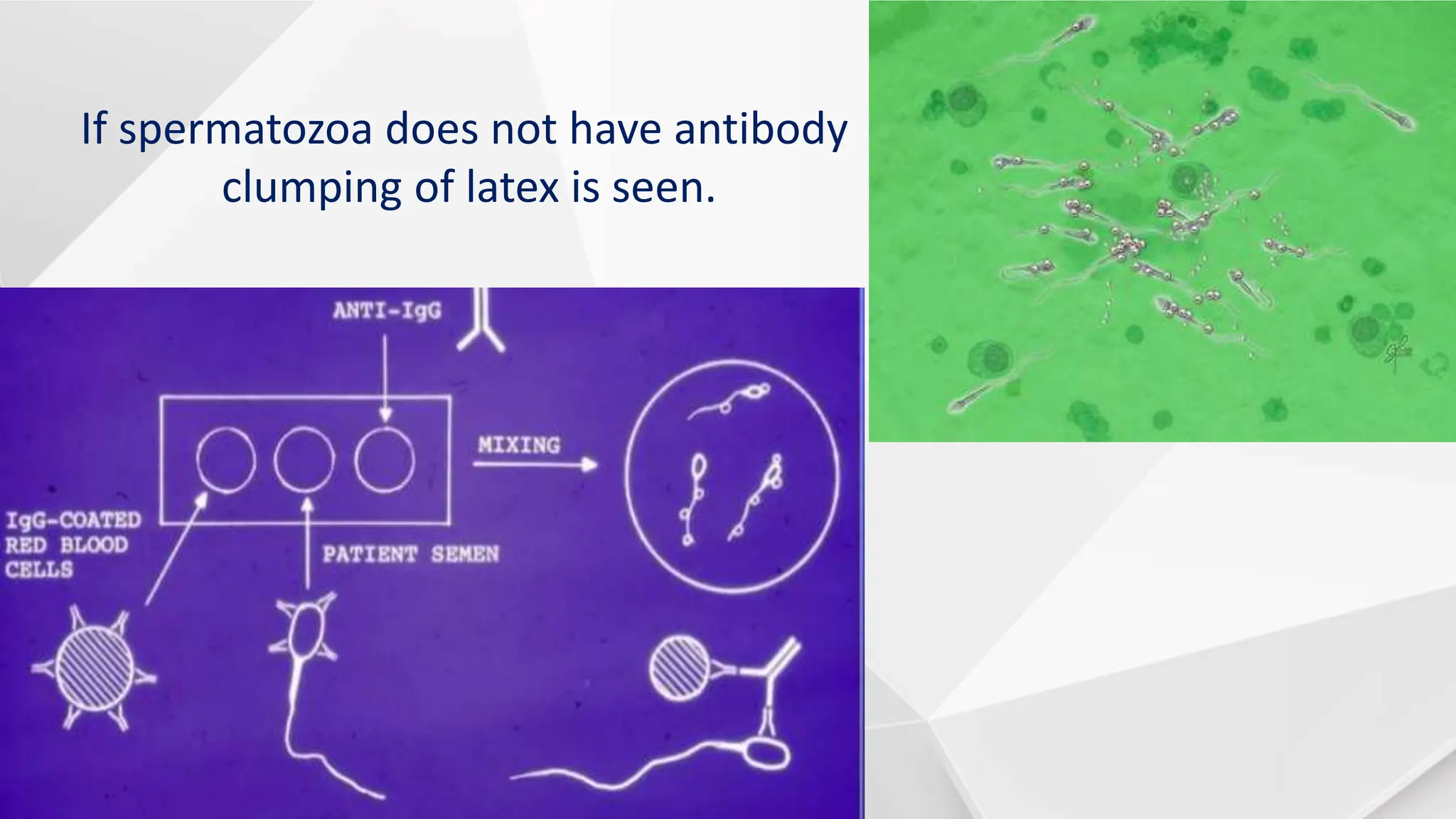 SEMEN ANALYSIS.pptx