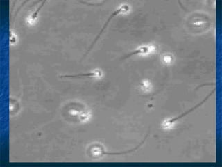 Semen Analysis. laboratory body fluid .ppt