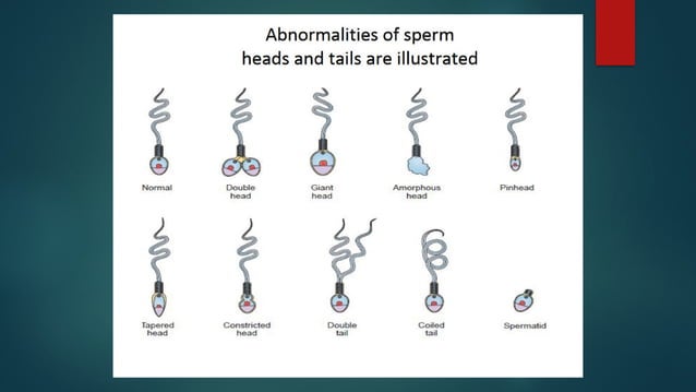 Semen Analysis, sperm and other components.pptx
