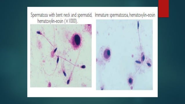 Semen Analysis, sperm and other components.pptx