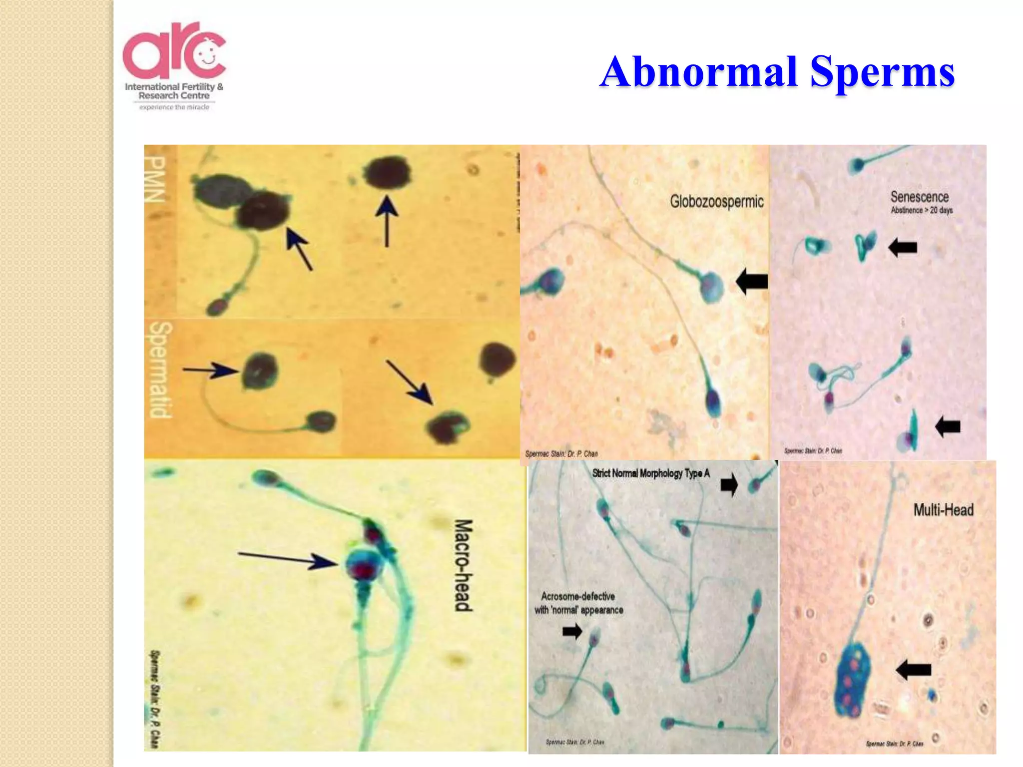 Semen analysis by Dr.Renukadevi | PPTX