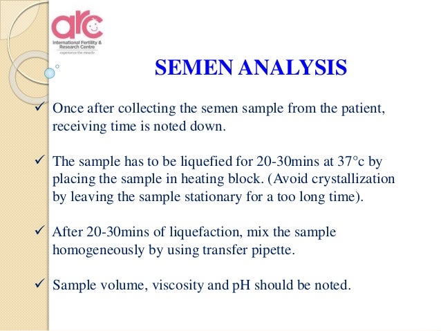 Semen Analysis Sample