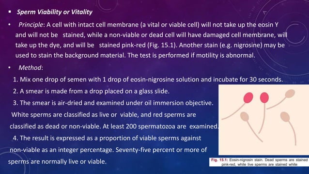 Semen analysis or seminal fluid analysis | PPTX | Infertility ...