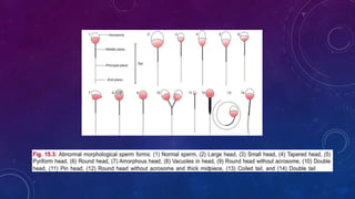 Semen analysis or seminal fluid analysis | PPTX