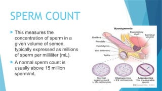 Detailed Study of SEMEN ANALYSIS Final-1.pptx
