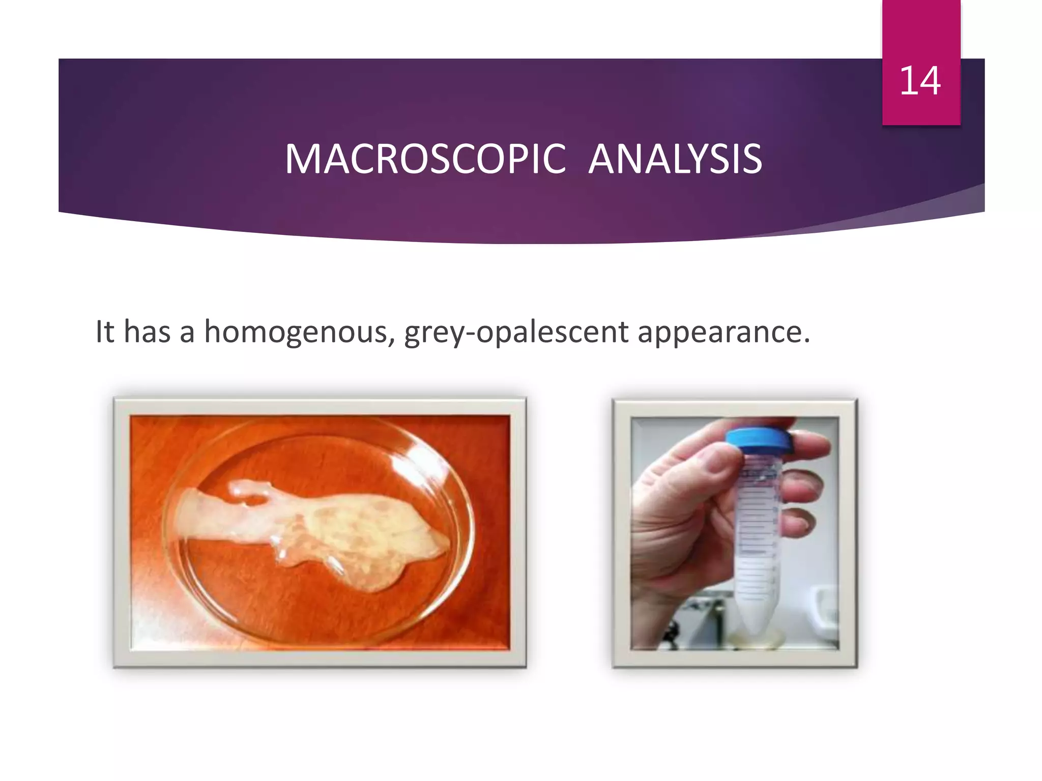 SEMEN ANALYSIS PPT.pptx