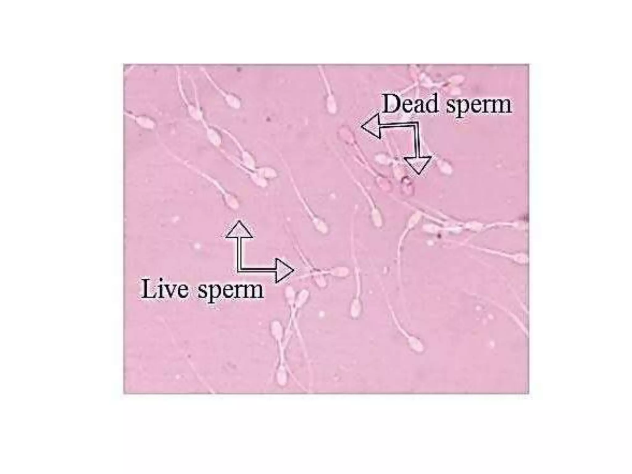 Semen Analysis Ppt Pptx