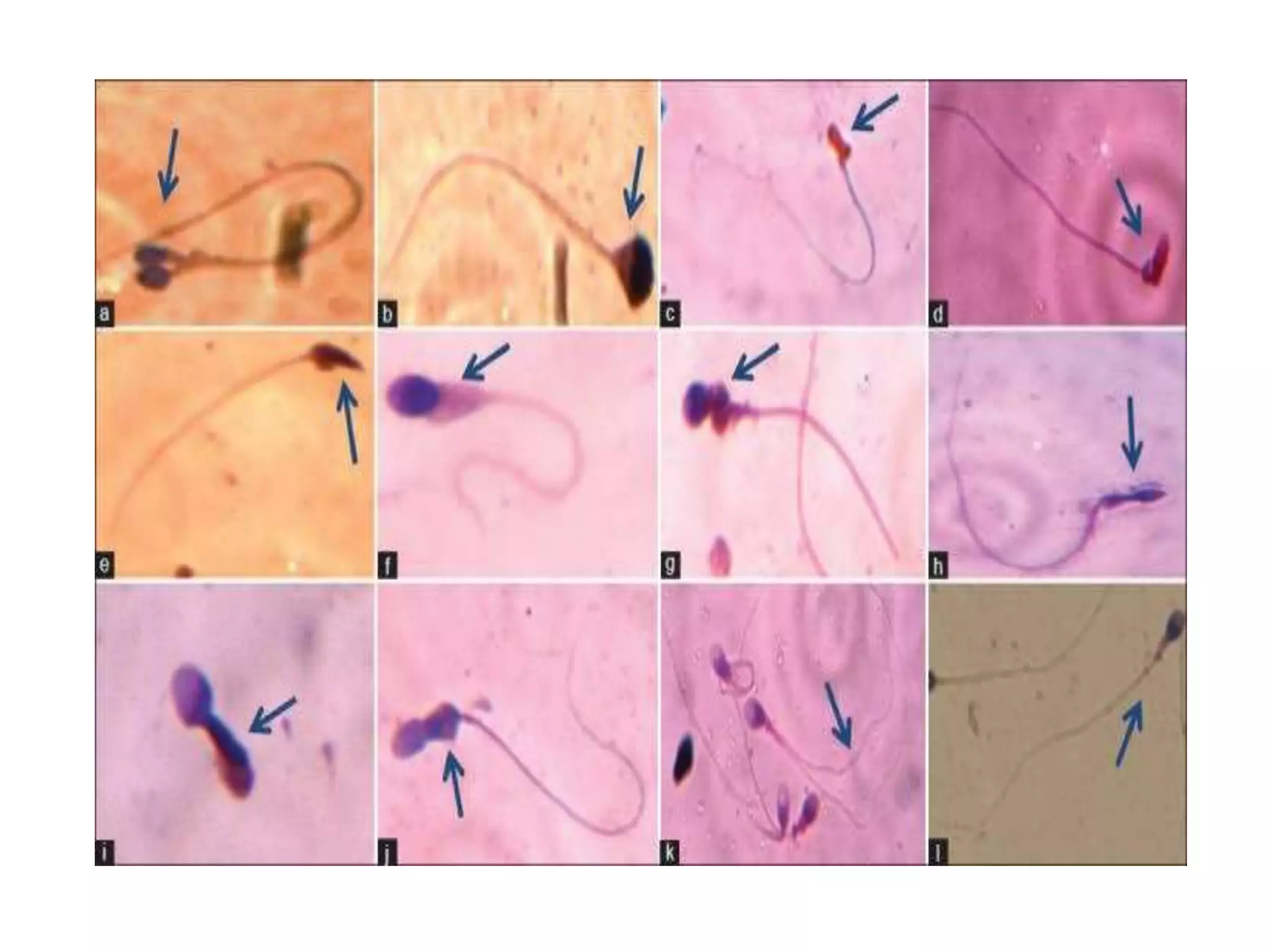 Semen Analysis Ppt Pptx
