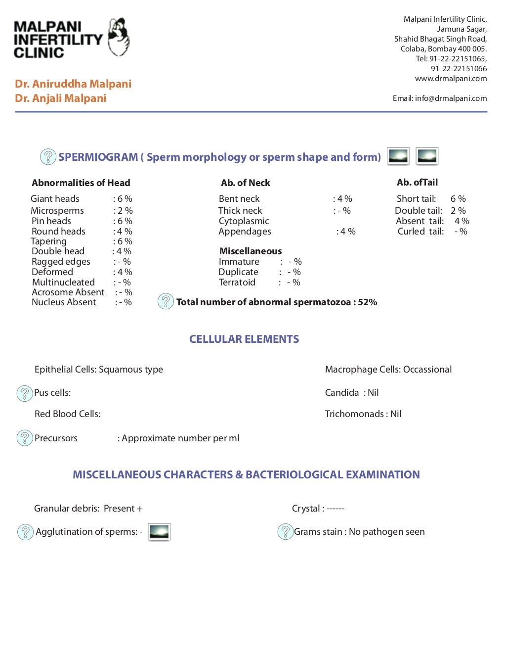 Sperm test ( semen analysis ) report - a patient's guie