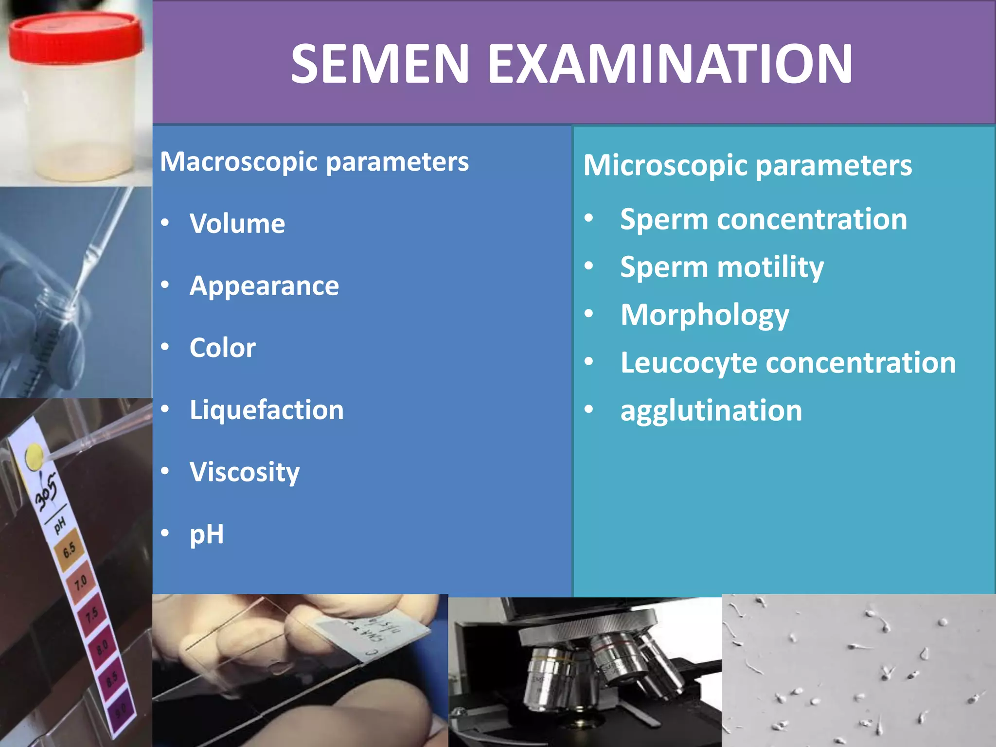 SEMEN ANALYSIS & W.H.O CRITERIA 2010 | PDF