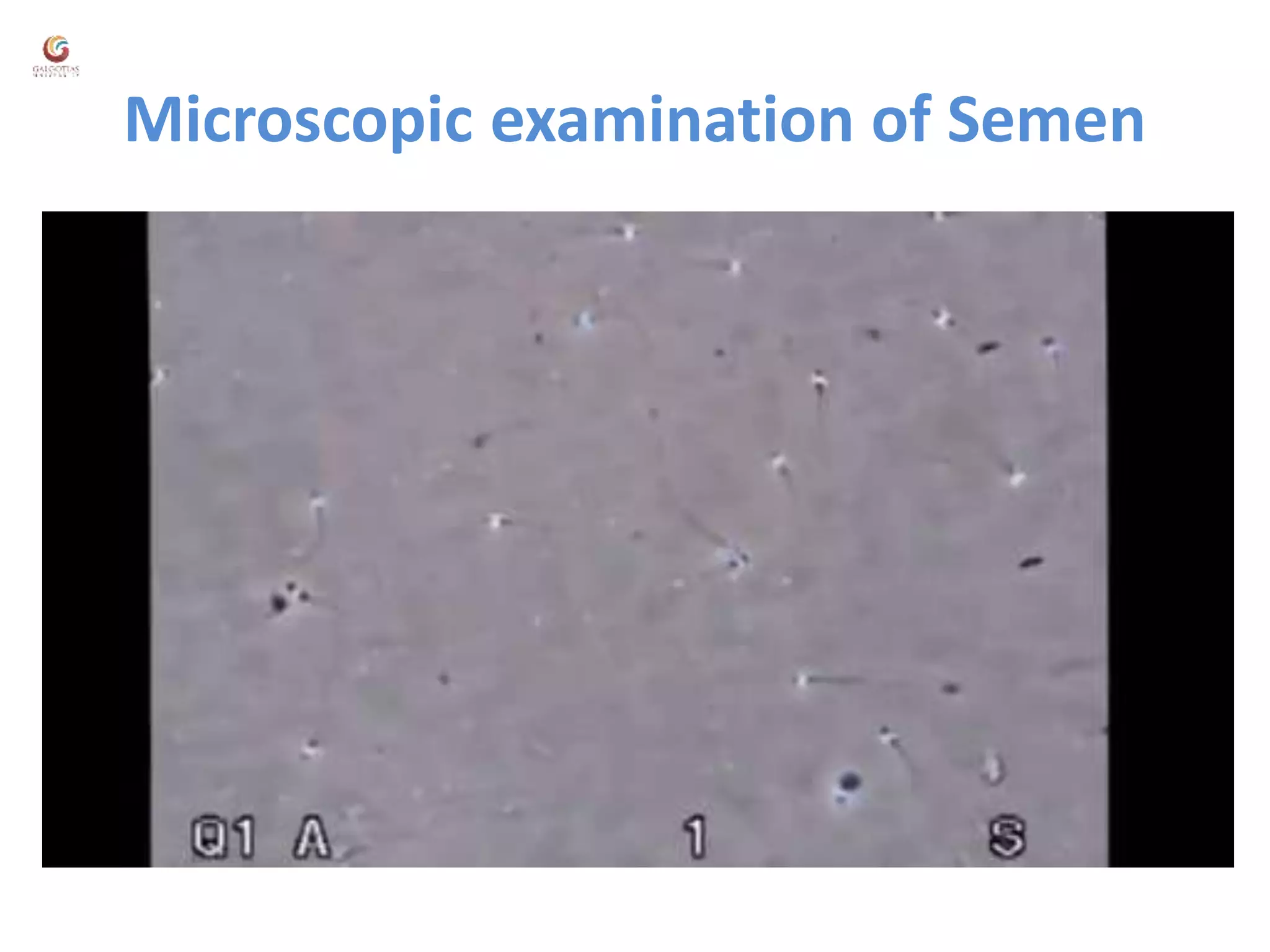 Semen examination for B.Sc. MLT students | PPTX