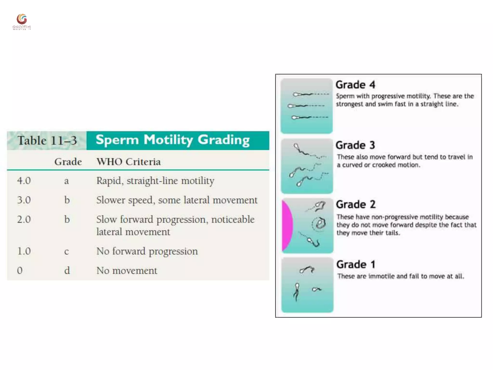 Semen examination for B.Sc. MLT students | PPTX | Infertility | Reproductive Health