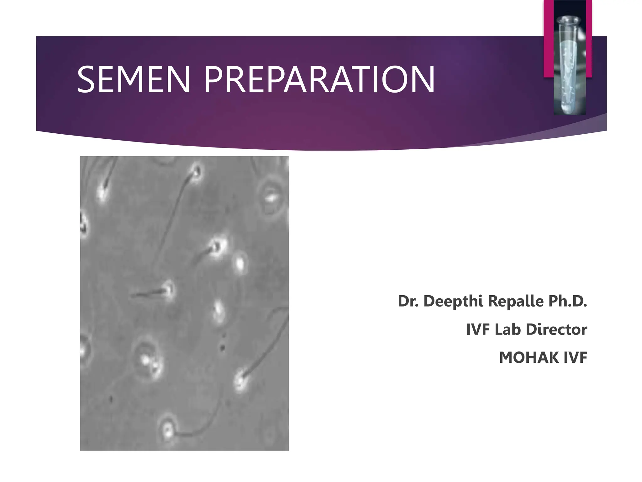 SEMEN PREPARATION TECHNIQUES FOR IVF IN EMBRYOLOGY | PPT