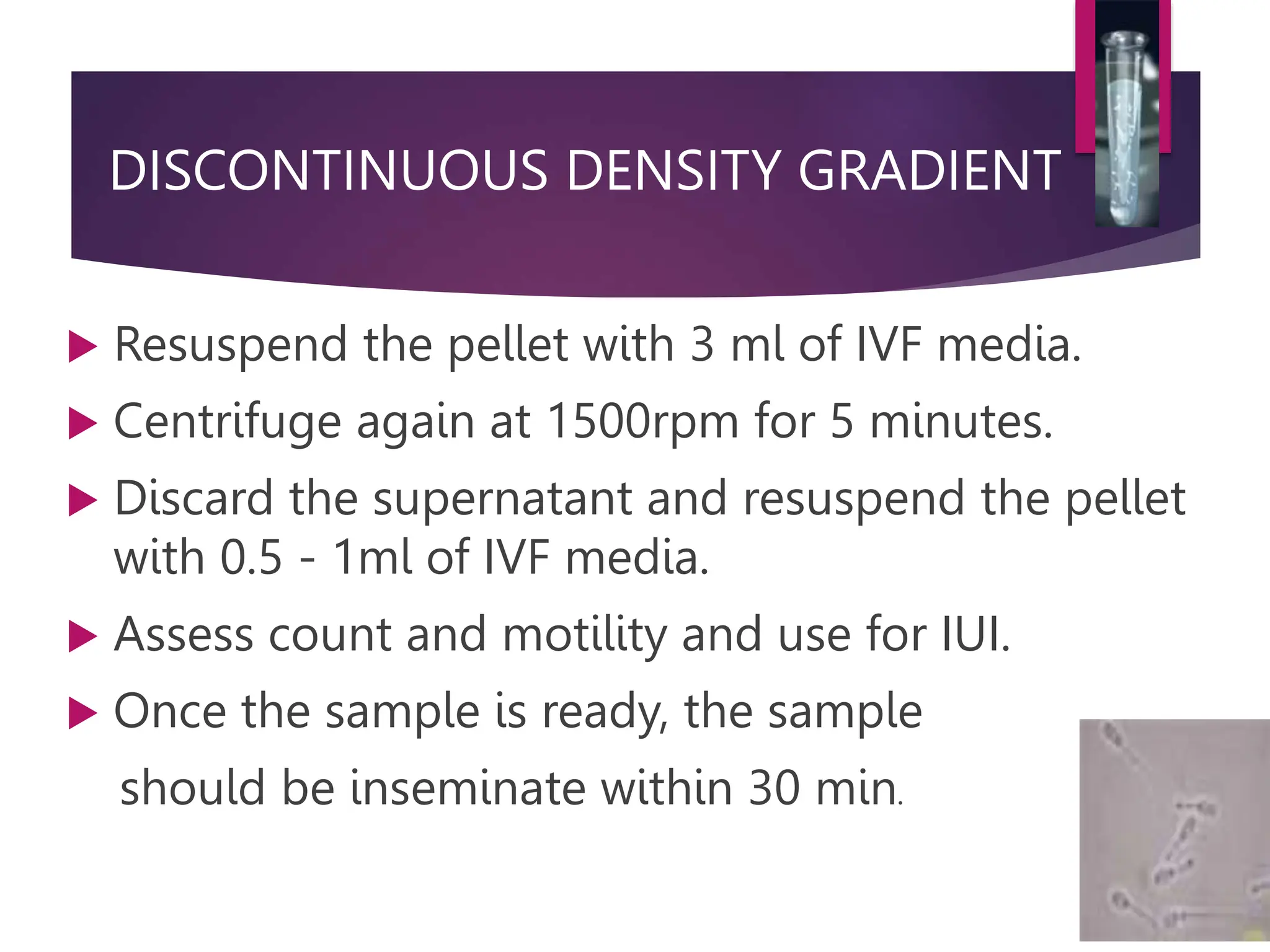 SEMEN PREPARATION TECHNIQUES FOR IVF IN EMBRYOLOGY | PPT