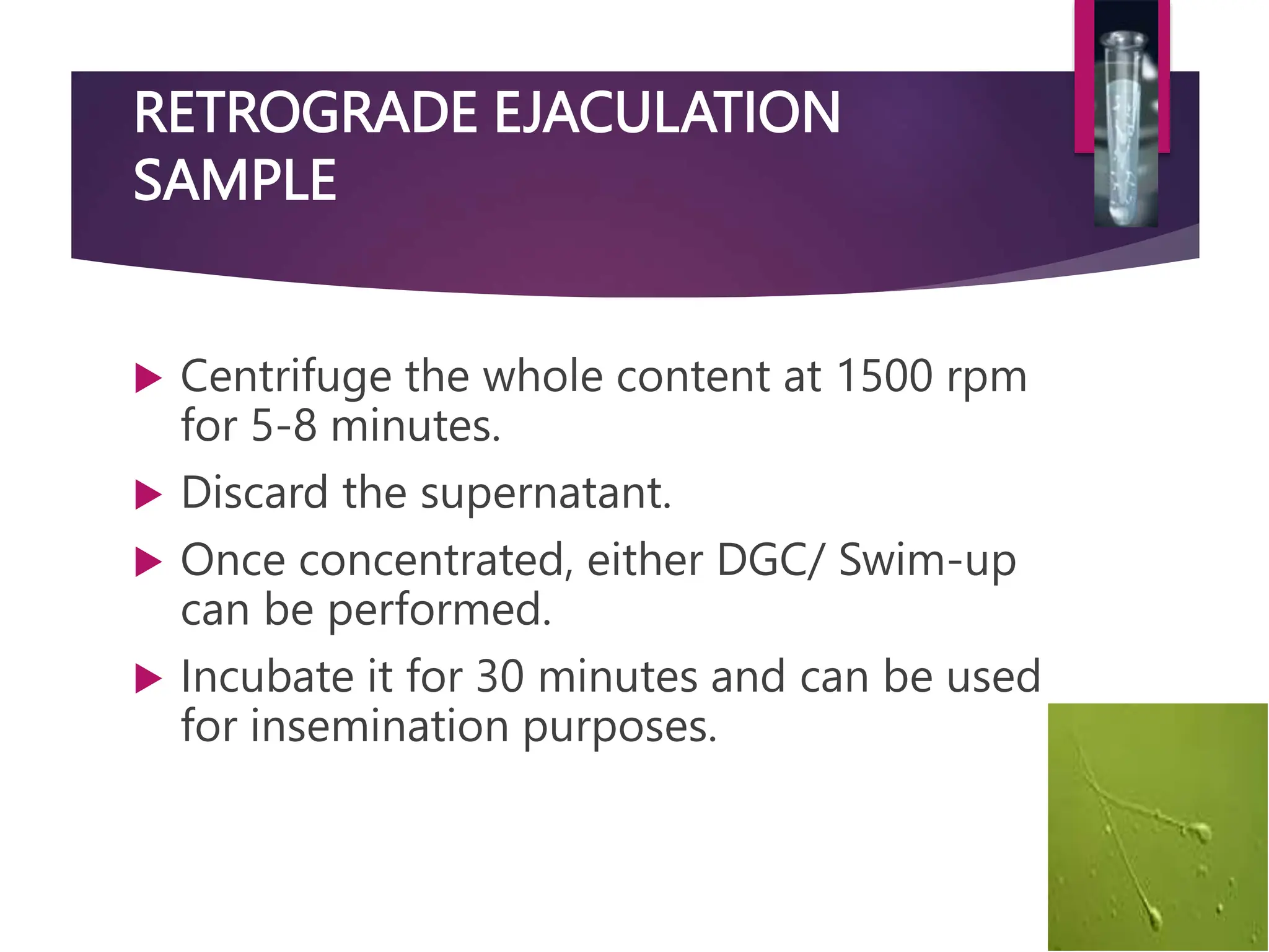 SEMEN PREPARATION TECHNIQUES FOR IVF IN EMBRYOLOGY | PPT