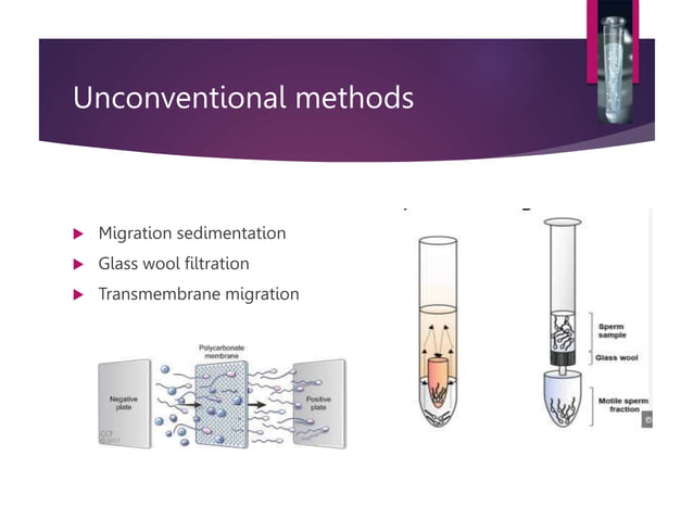 SEMEN PREPARATION TECHNIQUES FOR IVF IN EMBRYOLOGY | PPT