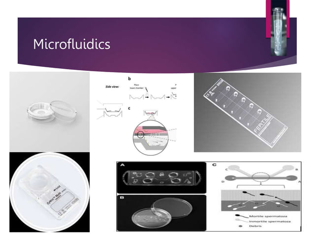 SEMEN PREPARATION TECHNIQUES FOR IVF IN EMBRYOLOGY | PPT