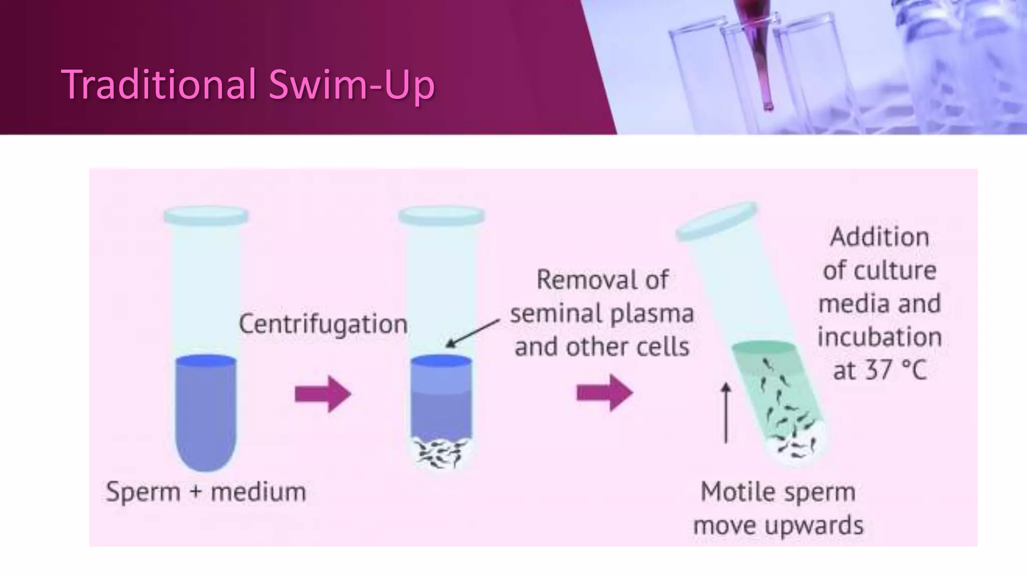 Semen Preparation Methods - Principles & Techniques | PPTX